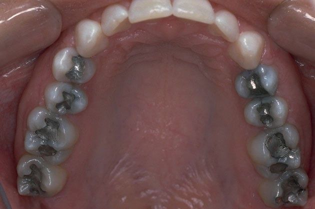 Danoff Dental & Associates, LLP | Little Neck, Queens